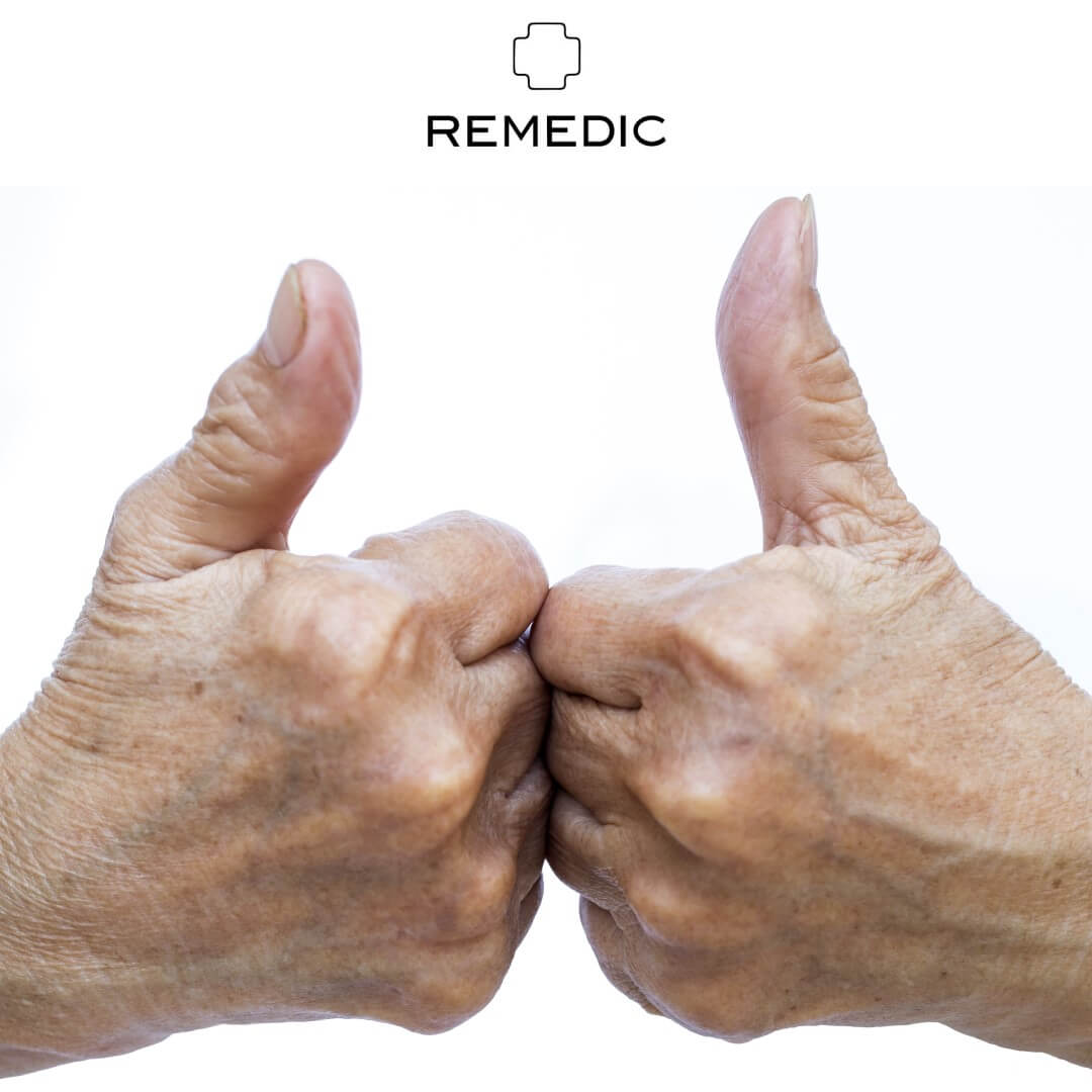 Living with Hand Arthritis: Understanding, Managing, and Thriving - Remedic